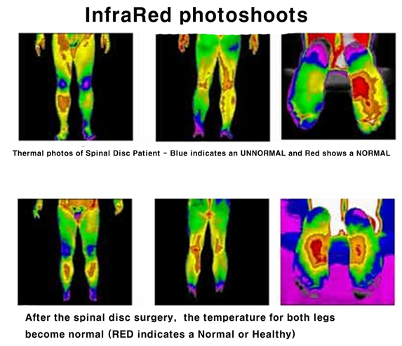 HeatFlex body temperature guard | A system to maintain body temperature